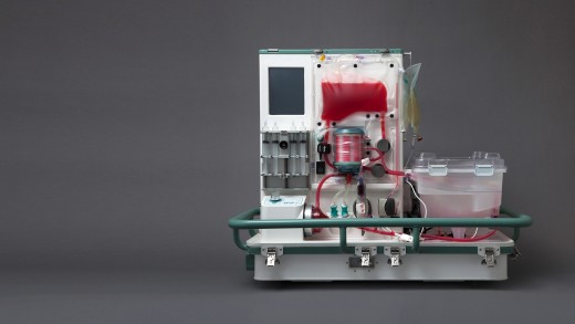 Developing the OrganOx Automated Liver Perfusion Device