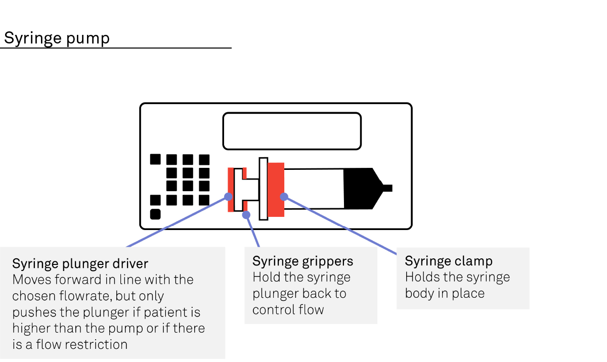 What are infusion pumps & how do they work? | Team Consulting