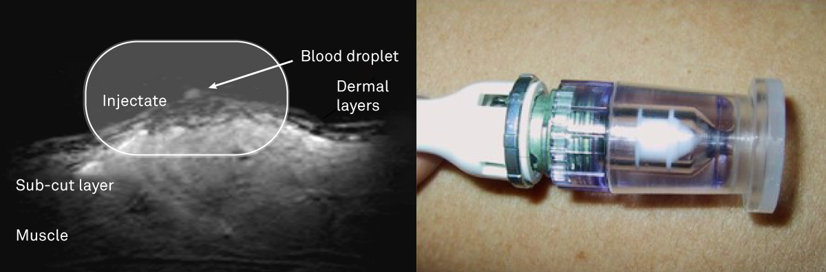 Preparing for mass vaccination | Team Consulting
