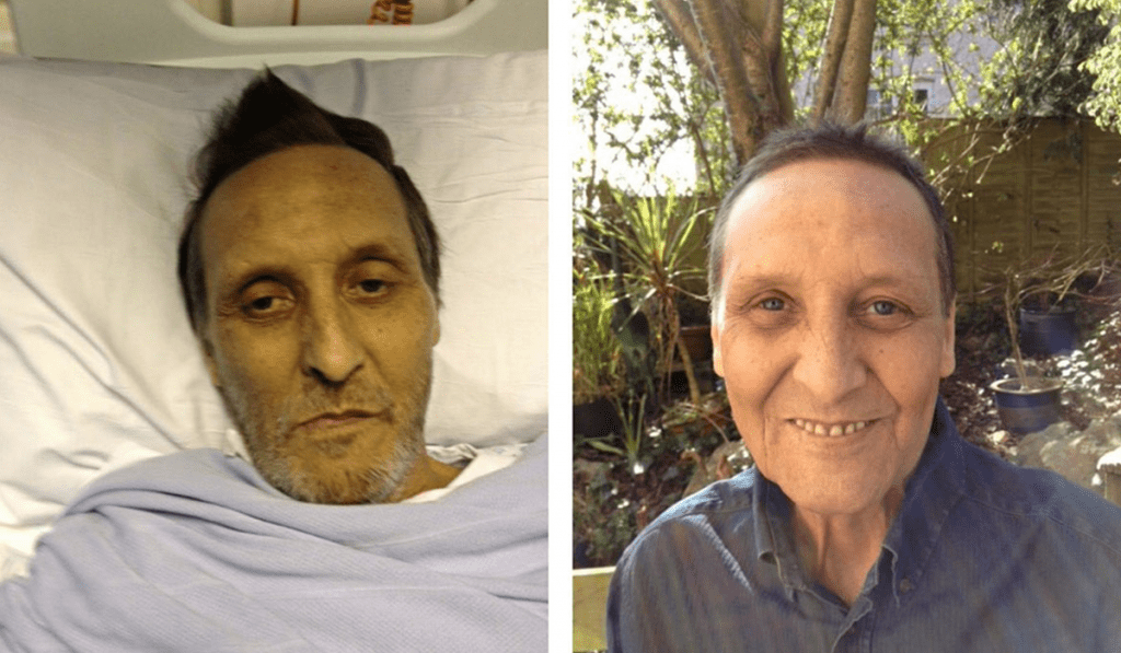 Developing the OrganOx Automated Liver Perfusion Device