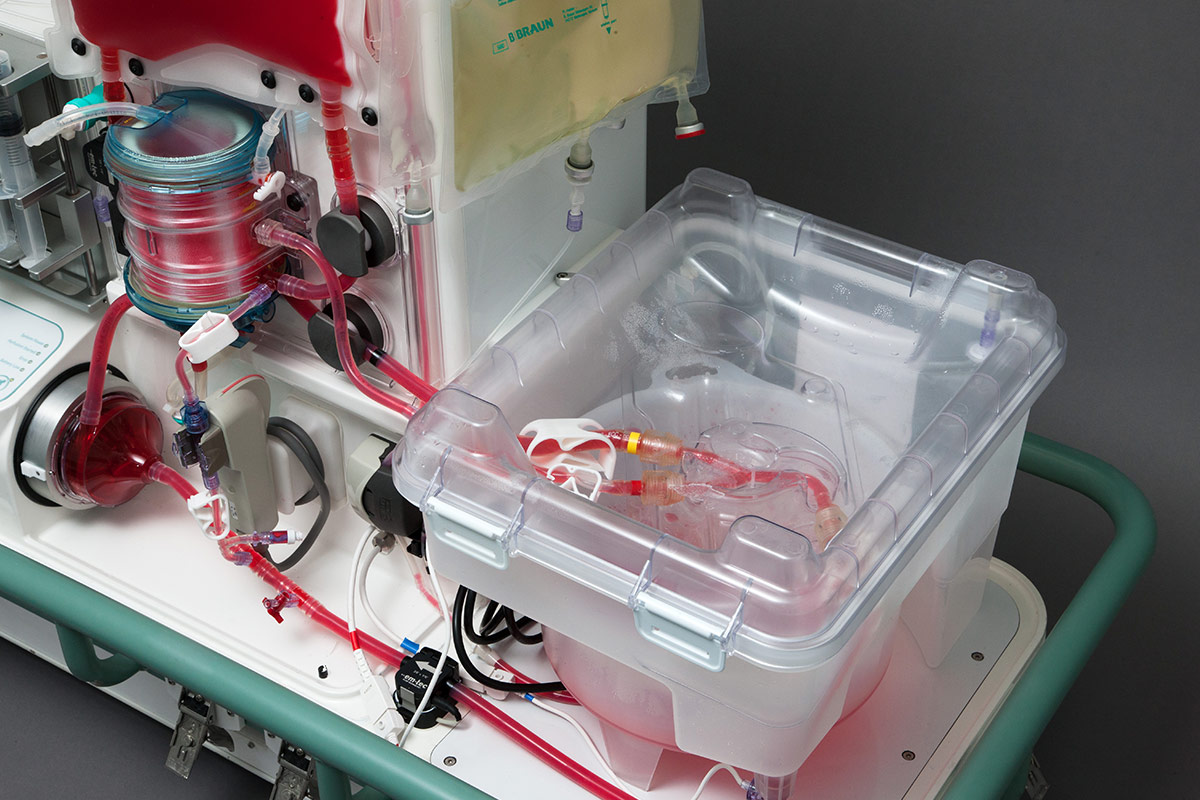 A world first in liver transplantation | Team Consulting