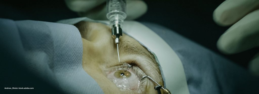 6 methods for delivering drugs to the eye | Team Consulting