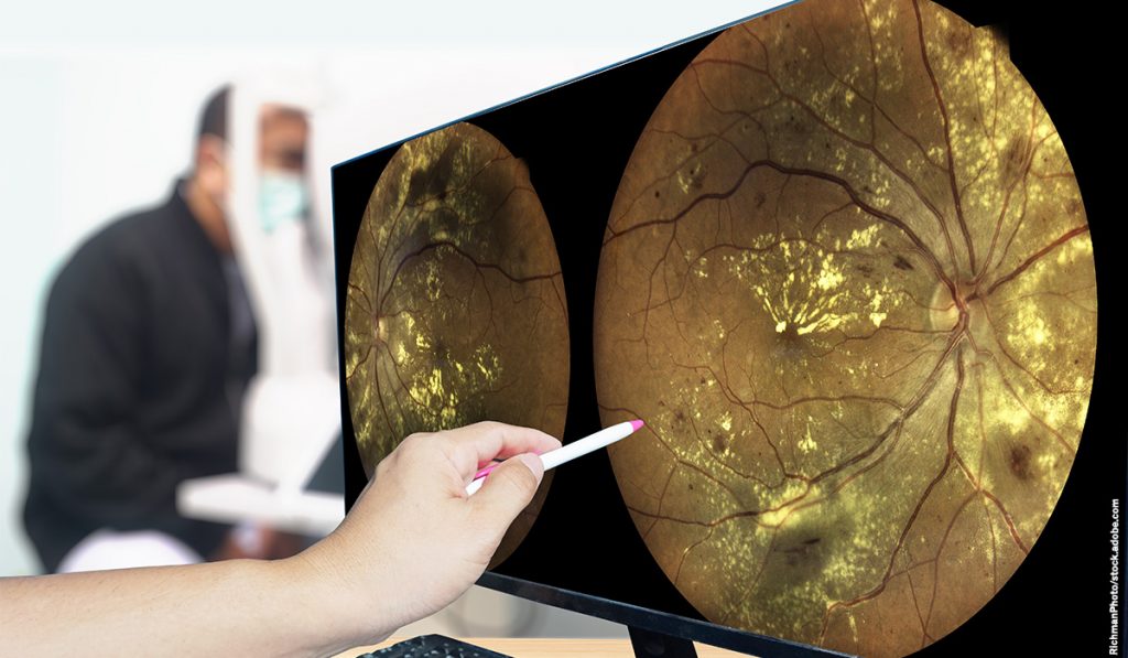 Retinal devices: how improved technical capability saved my sight ...