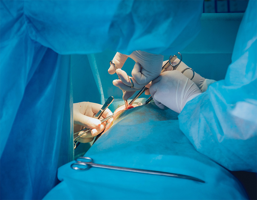 Controlling breast surgery incisions | Team Consulting
