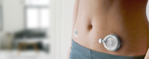 Developing a Wearable Patch Pump® | Team Consulting