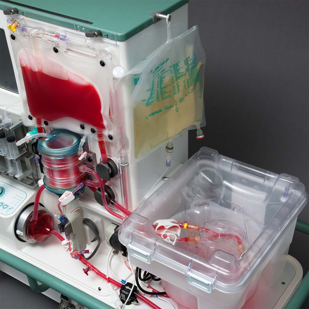 Developing the OrganOx Automated Liver Perfusion Device