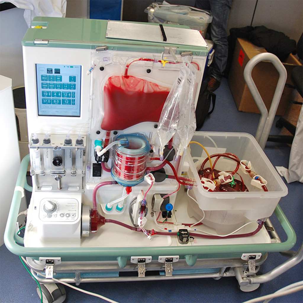 Developing the OrganOx Automated Liver Perfusion Device