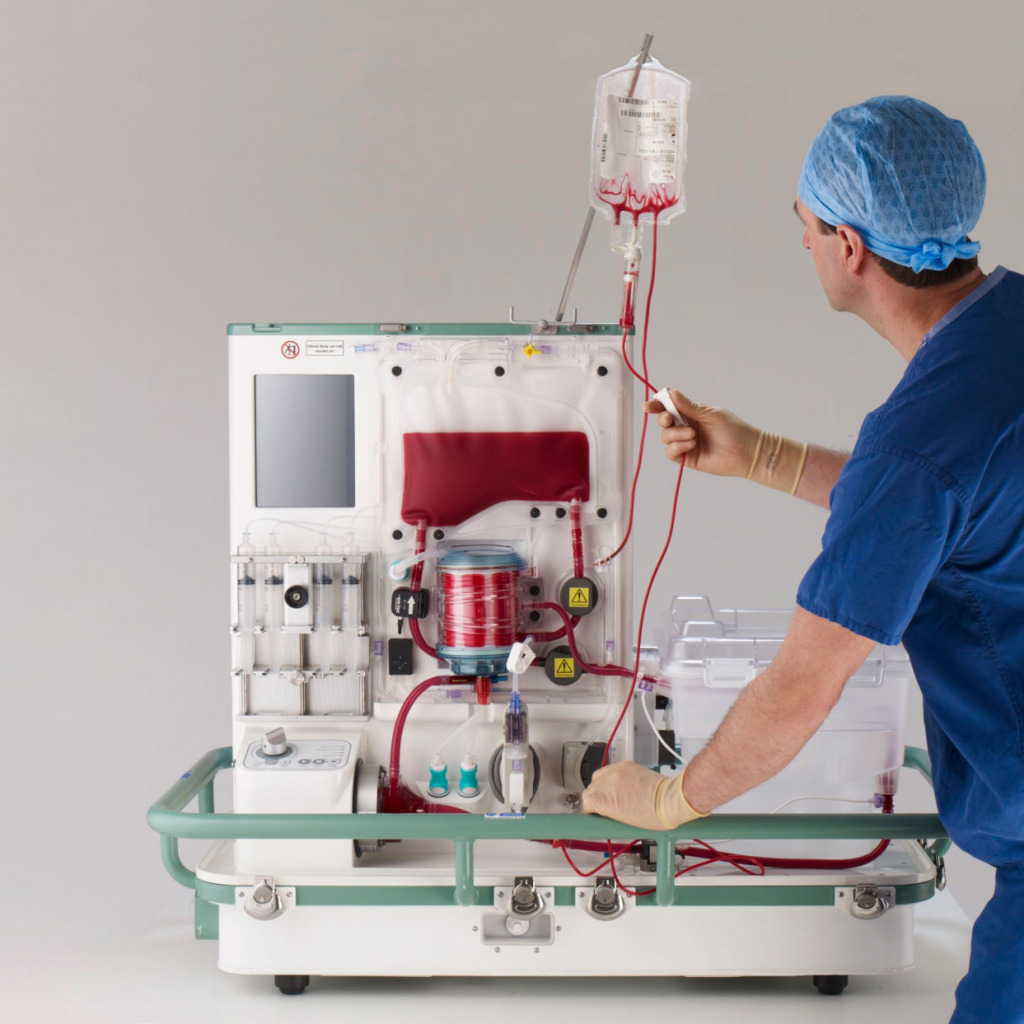 Developing the OrganOx Automated Liver Perfusion Device