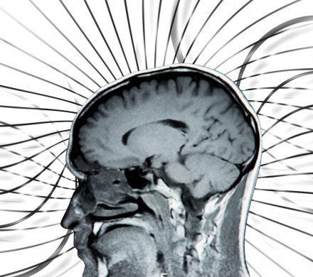 Improving access to magnetic encephalogram diagnostics | Team Consulting