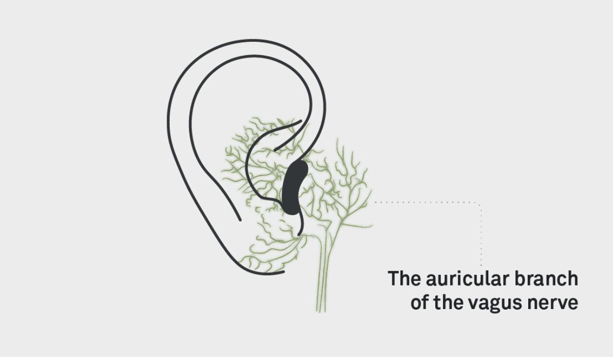 Earables: the future of wearable health | Team