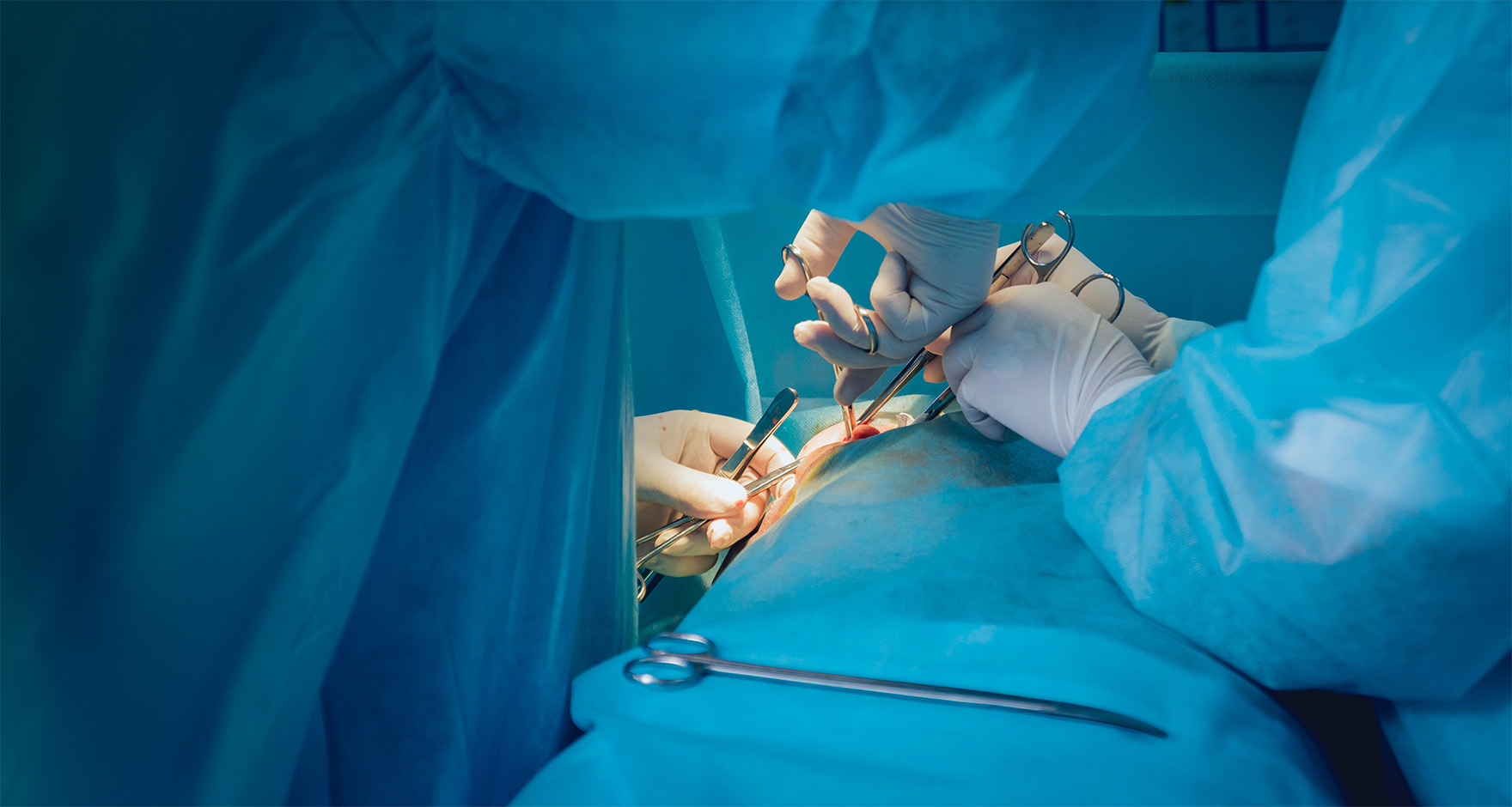 Controlling breast surgery incisions | Team Consulting