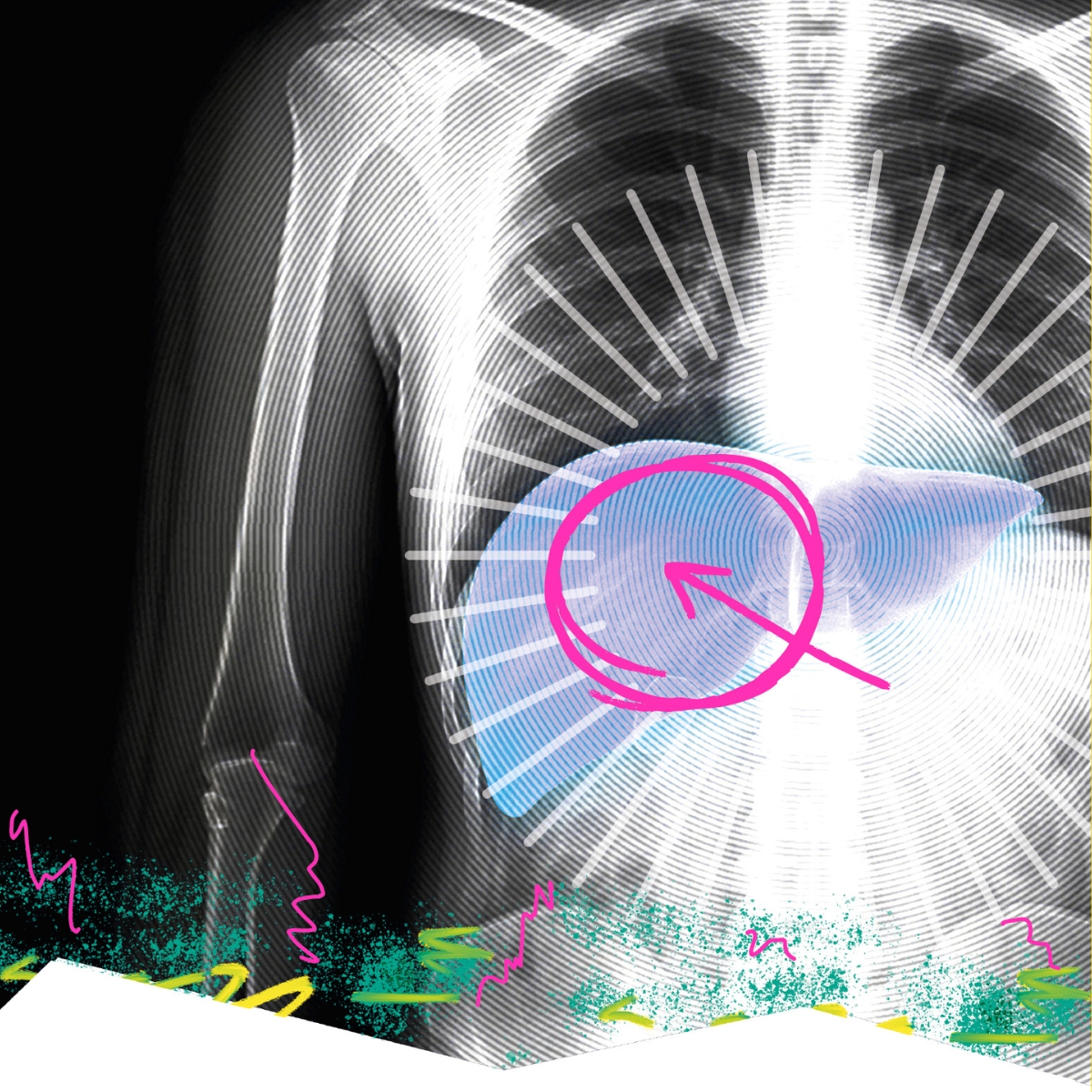 Radioligand therapies for cancer treatment | Team Consulting