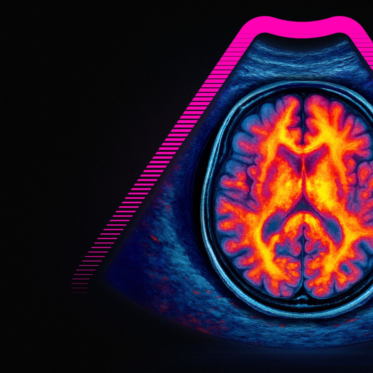 Breaking barriers with ultrasound: unlocking the brain’s defences ...